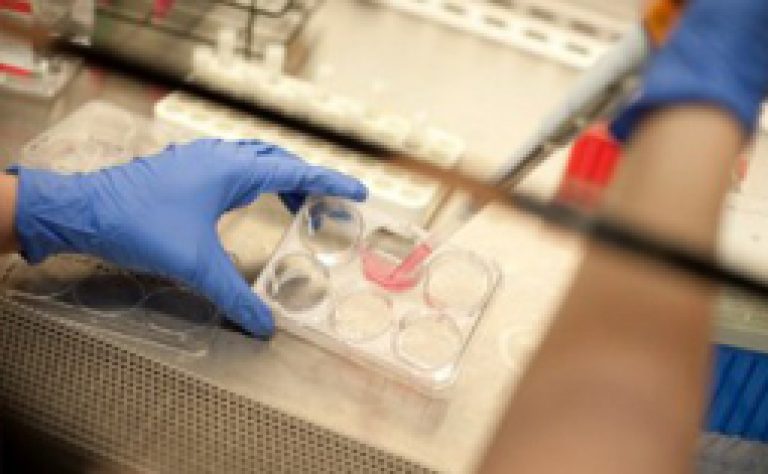 Generation of Induced Pluripotent Stem (iPS) Cells from Genetically ...