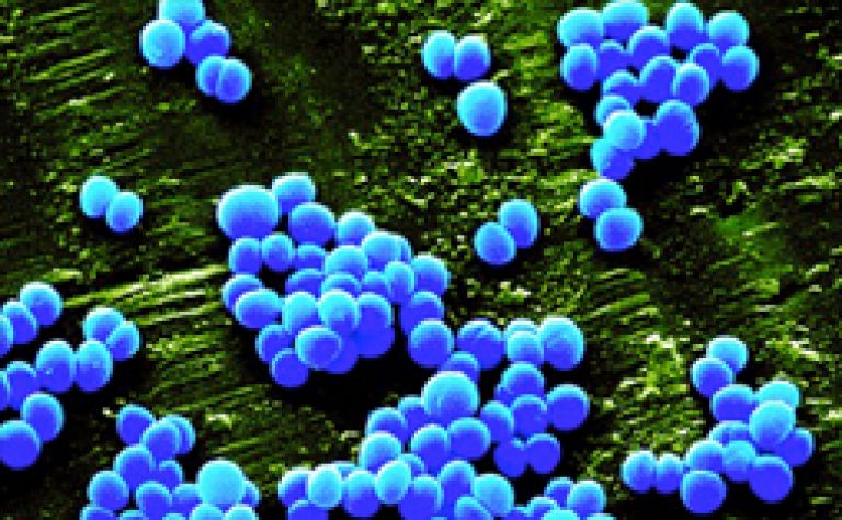 Role of Staphylococcal Pathogen Associated Molecular Patterns in Septic ...