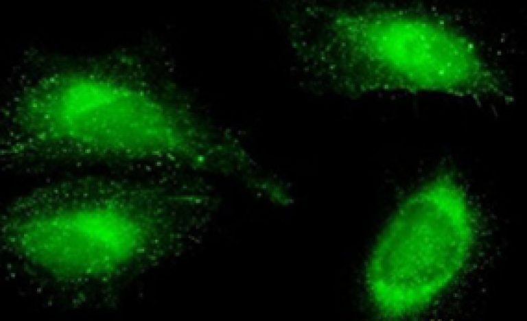 Fibronectin Purification and Fragmentation - Amrita Vishwa Vidyapeetham