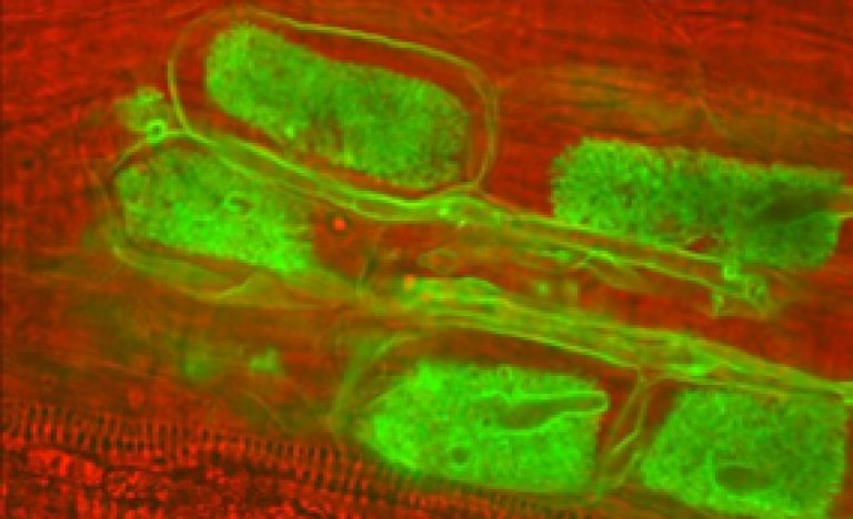 Ribotyping- Ribotyping of Bacterial Endophytes - Amrita Vishwa Vidyapeetham