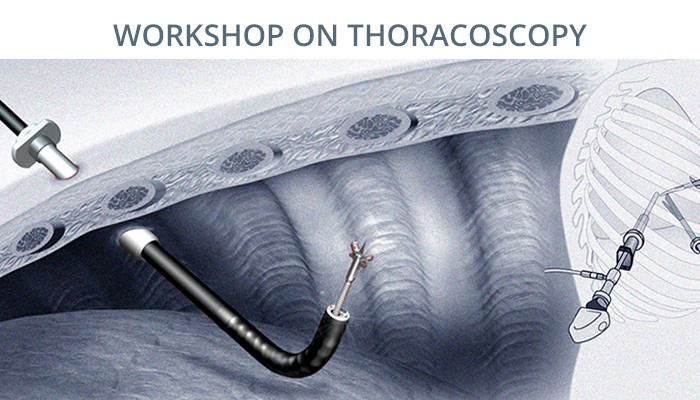 Workshop on Thoracoscopy - Amrita Vishwa Vidyapeetham